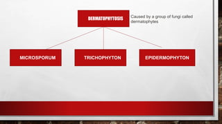 Fungal Infections.pptx