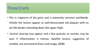 Fungal Infections.pptx