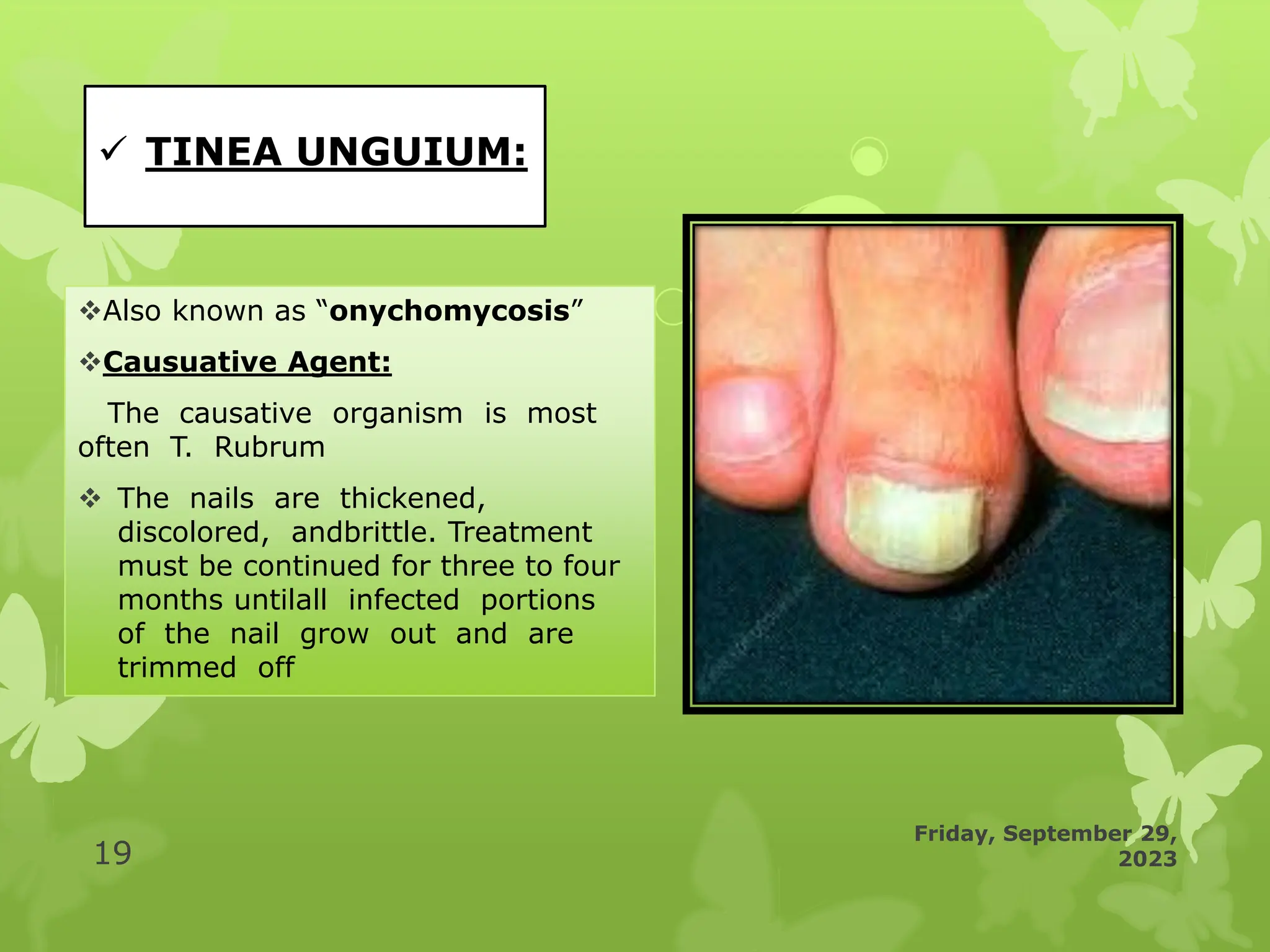 Understanding Fungal Skin Infections and Ringworm: Causes, Symptoms ...