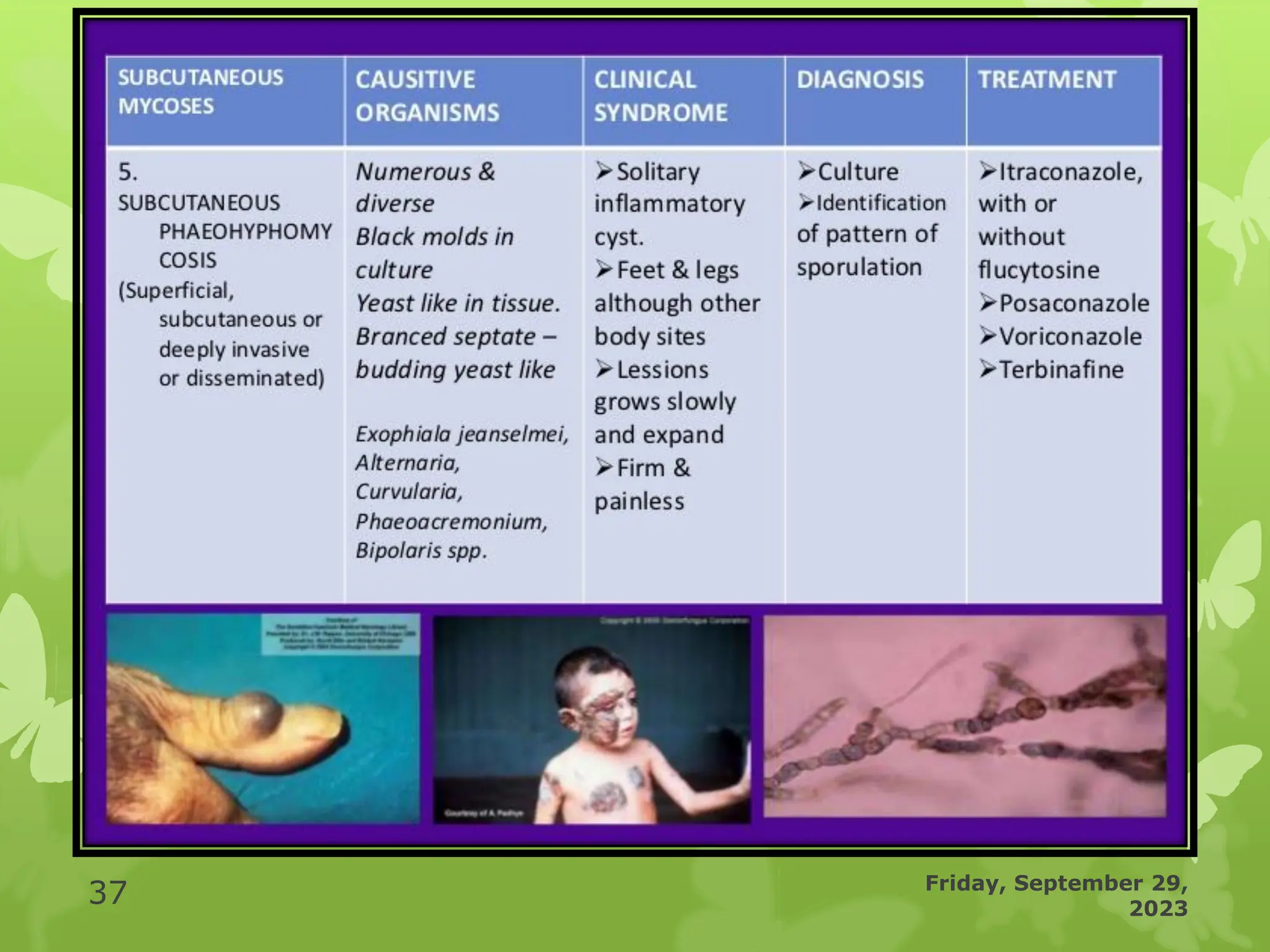 Understanding Fungal Skin Infections and Ringworm: Causes, Symptoms ...