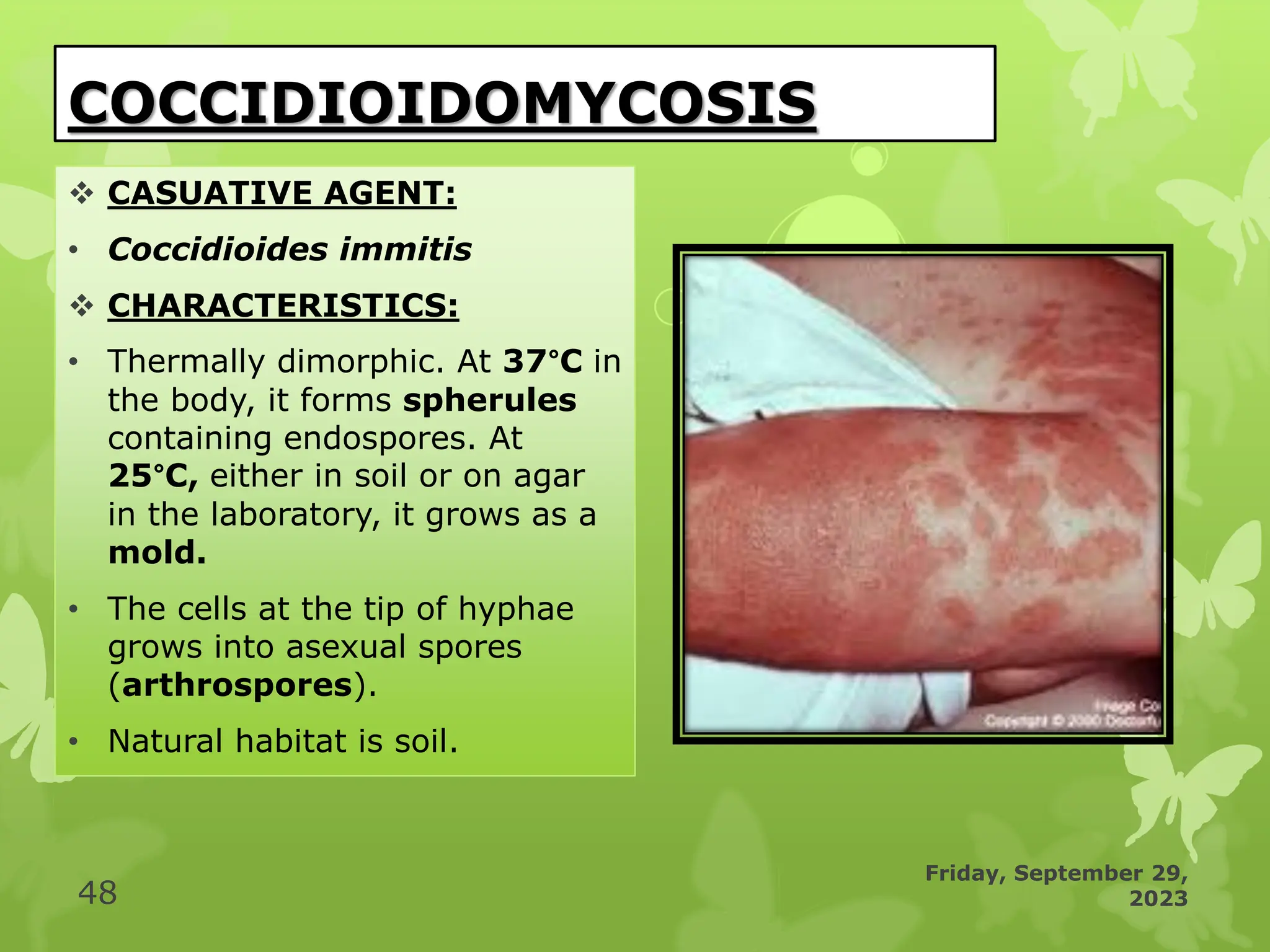 Understanding Fungal Skin Infections and Ringworm: Causes, Symptoms ...