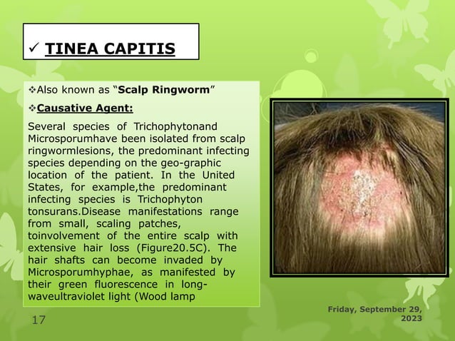 Understanding Fungal Skin Infections and Ringworm: Causes, Symptoms, and Treatment Options.pdf