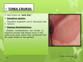 Understanding Fungal Skin Infections and Ringworm: Causes, Symptoms ...
