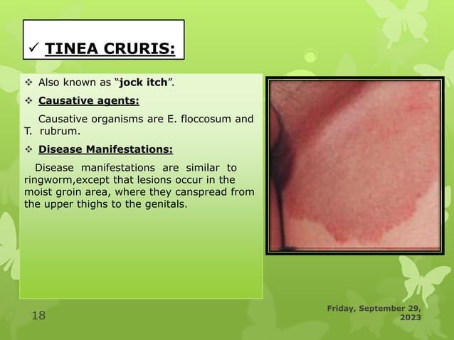 Understanding Fungal Skin Infections and Ringworm: Causes, Symptoms, and Treatment Options.pdf