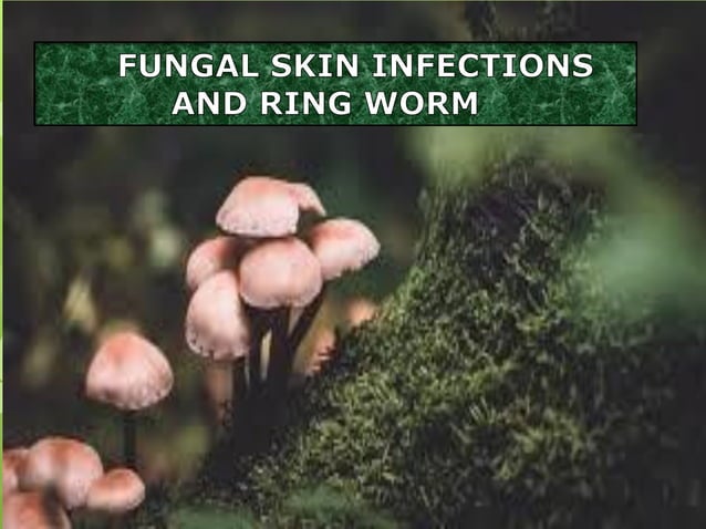 Understanding Fungal Skin Infections and Ringworm: Causes, Symptoms, and Treatment Options.pdf