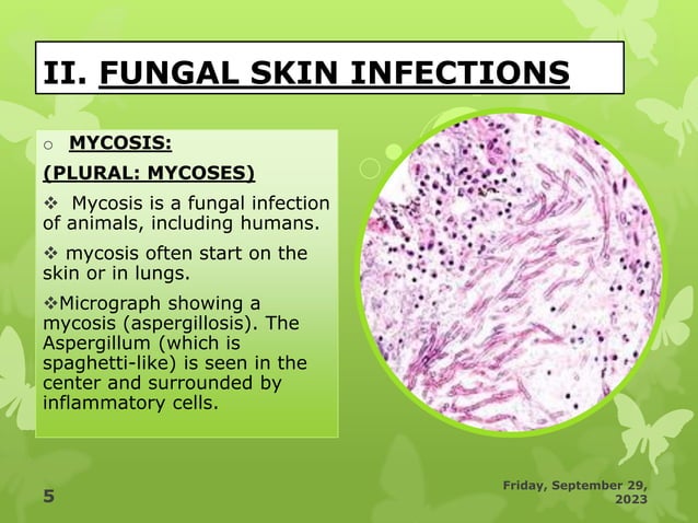 Understanding Fungal Skin Infections and Ringworm: Causes, Symptoms ...