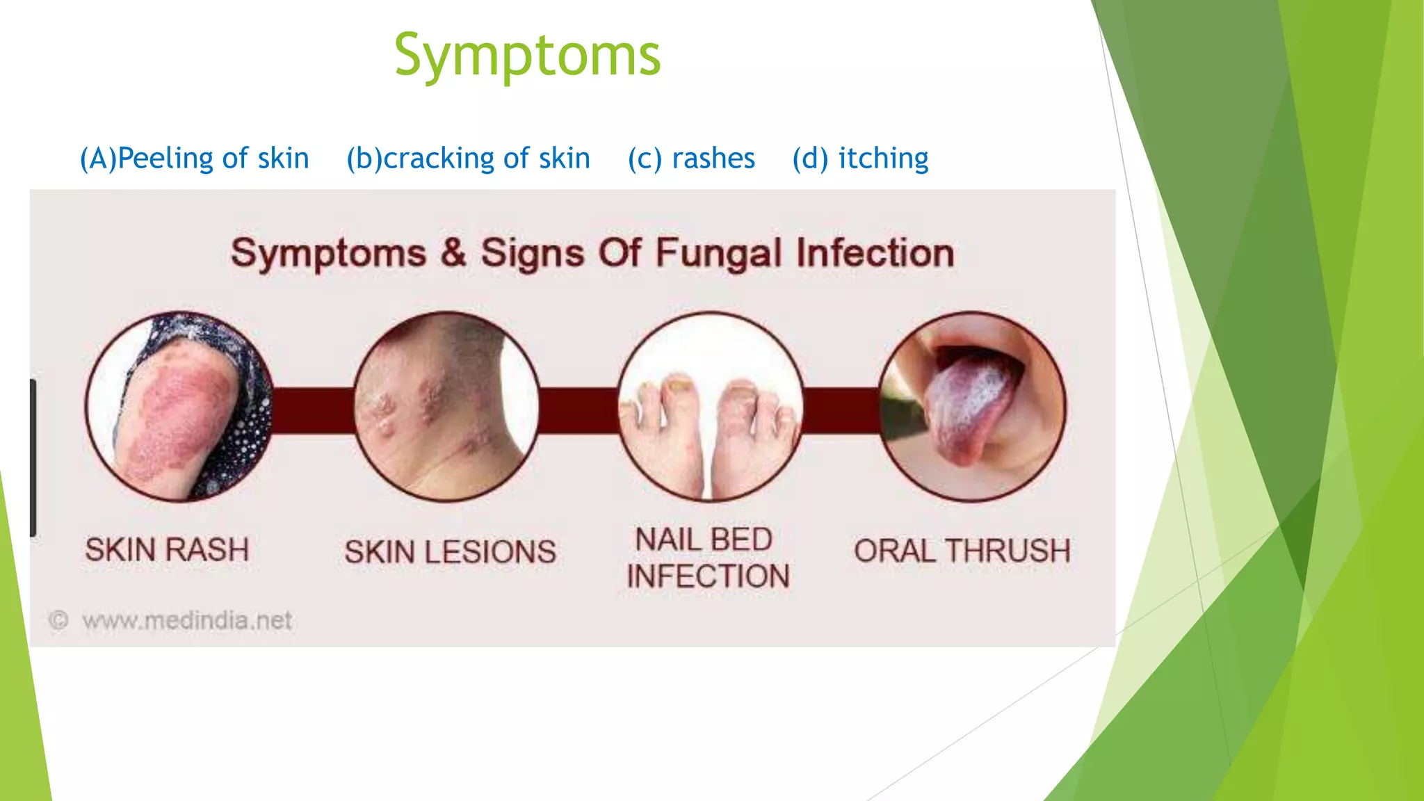 Fungal infections | PPT