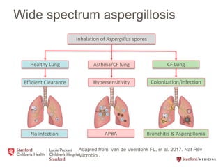 Fungal infections in CF.pptx
