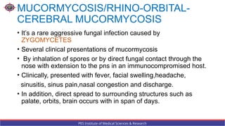 FUNGAL INFECTIONS IN ENT otorhinolaryngology.ppt