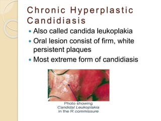 Fungal infections of head and neck | PPTX