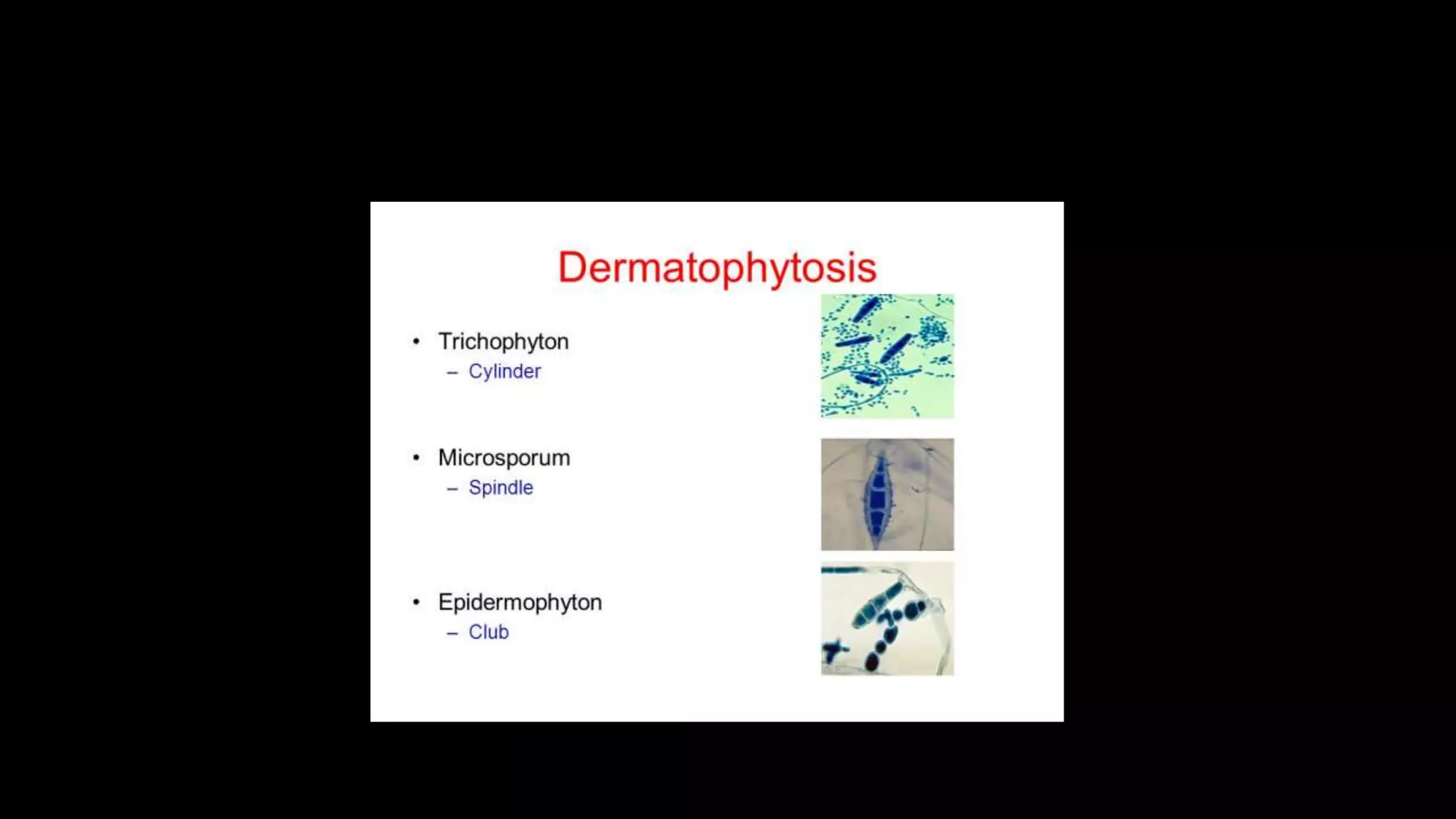 Fungal infections of skin | PPT