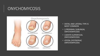 Fungal infections of skin | PPT