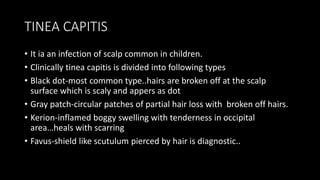 Fungal infections of skin | PPT