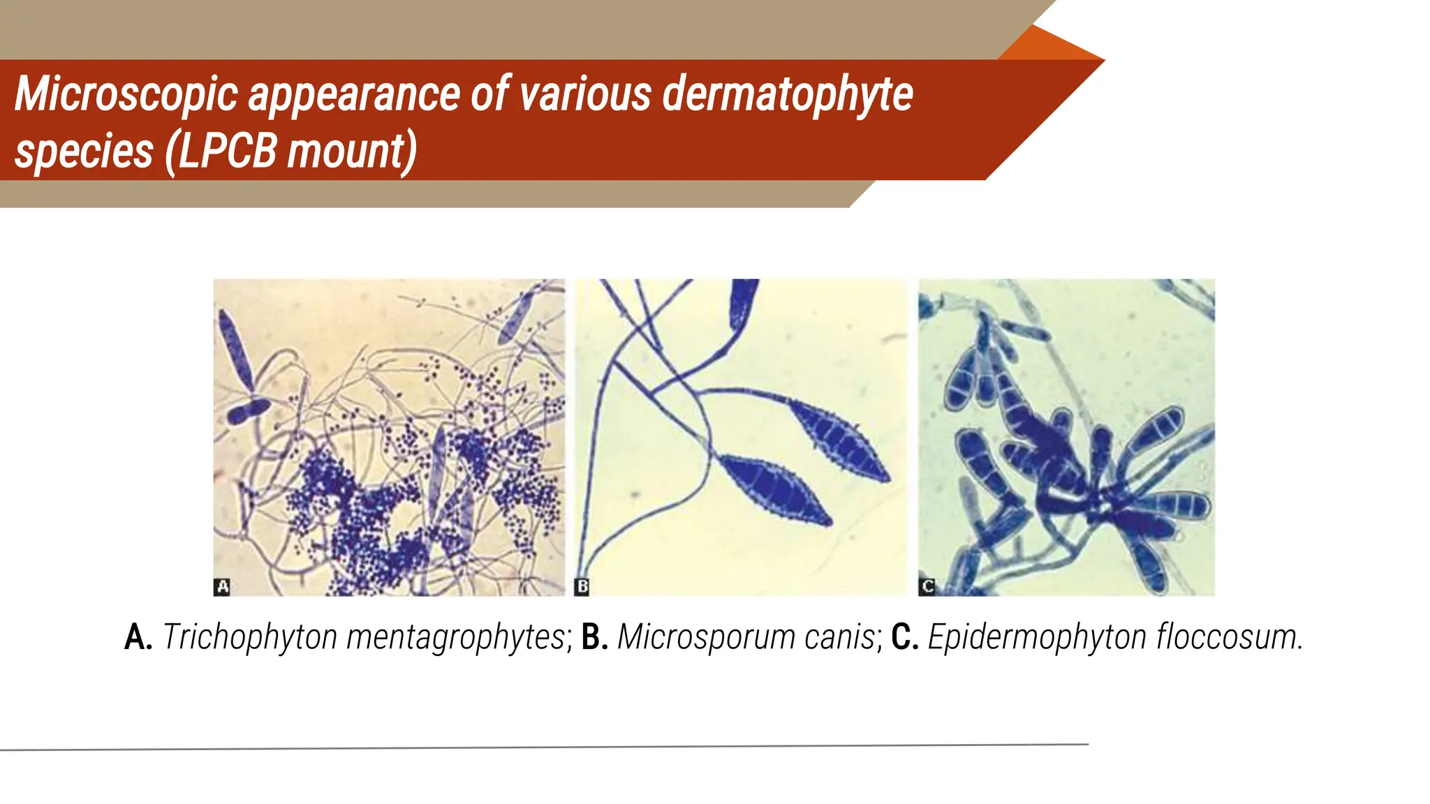 Fungal Infections of Skin, Soft tissue.pptx