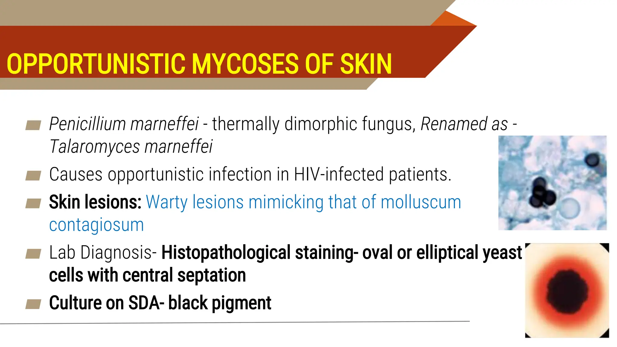 Fungal Infections of Skin, Soft tissue.pptx