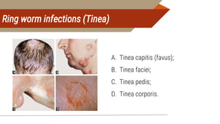 Fungal Infections of Skin, Soft tissue.pptx | Skin and Dermatology ...