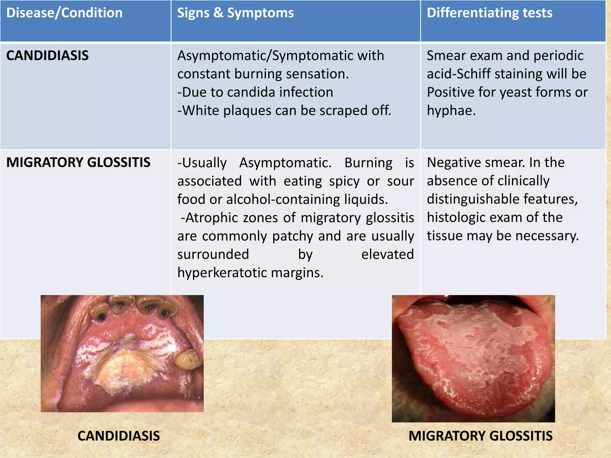Fungal infections of the oral cavity | PPTX