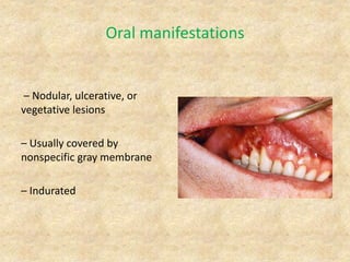 Fungal Infections Of The Oral Cavity PPTX
