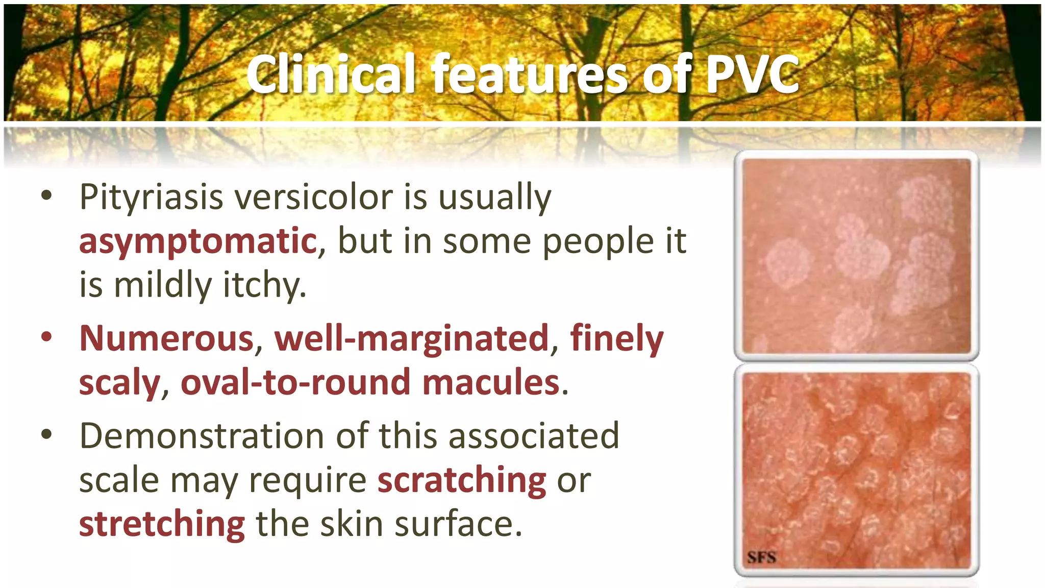 Fungal infections part I | PPTX