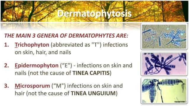 Fungal infections part III | PPT