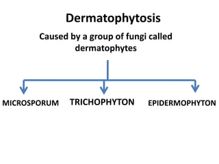 Fungal infections prenav | PPTX