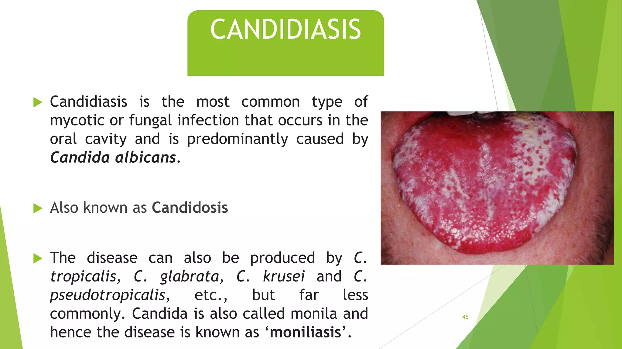 FUNGAL INFECTIONS OF ORAL CAVITY | PPTX