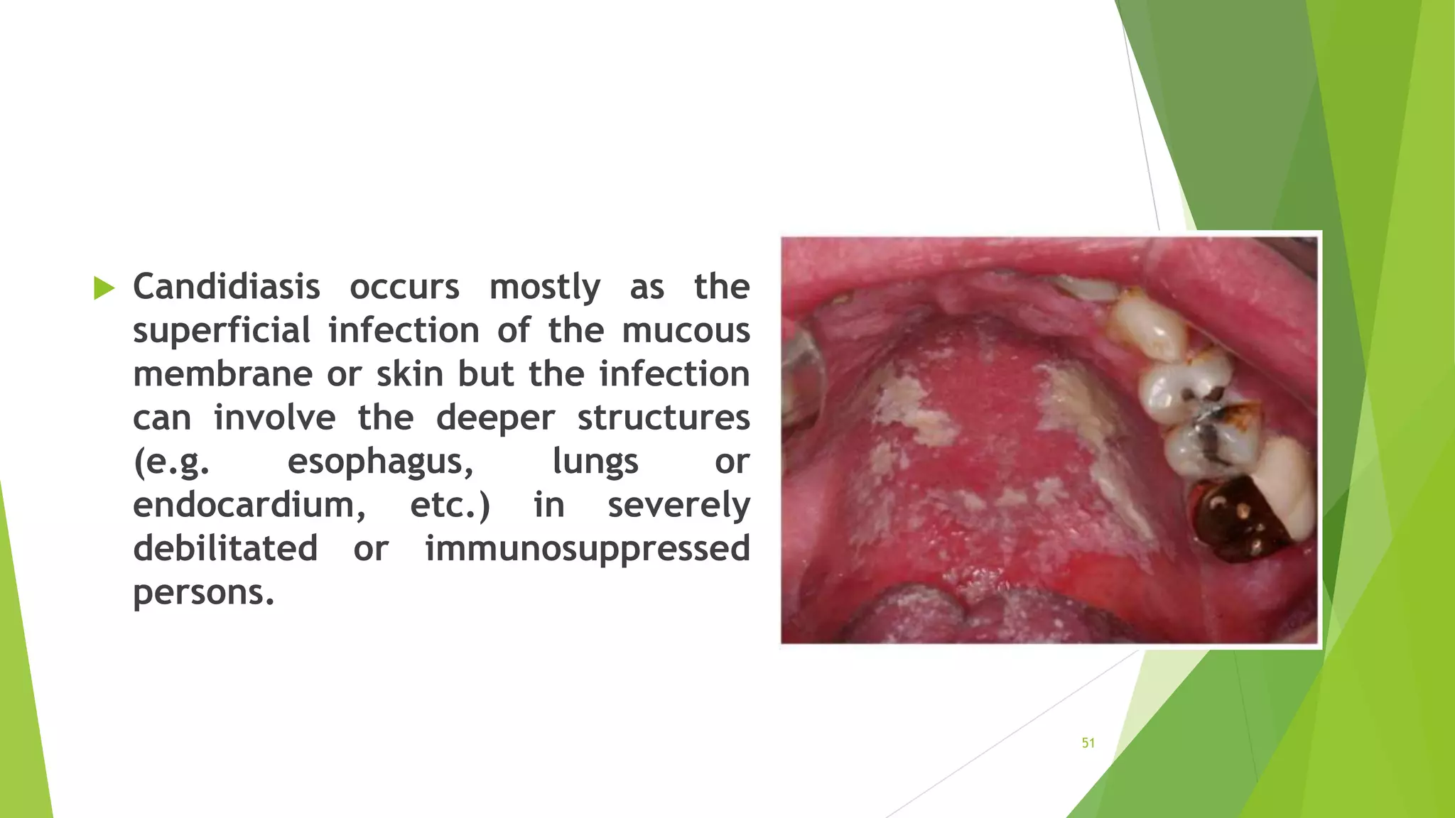 FUNGAL INFECTIONS OF ORAL CAVITY | PPTX | Dental Health | Diseases and ...