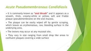 FUNGAL INFECTIONS OF ORAL CAVITY | PPTX