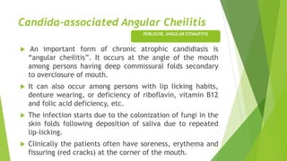 FUNGAL INFECTIONS OF ORAL CAVITY | PPTX