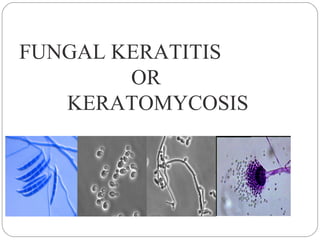 Keratomycosis