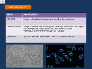FUNGAL KERATITIS , CLINICAL FEATURES , DIAGNOSIS , TREATMENT | PPTX