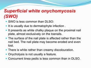 Nails Fungal infections | PPTX | Foot Health | Diseases and Conditions