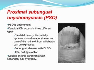 Nails Fungal infections | PPTX