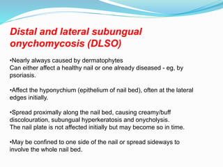 Nails Fungal infections | PPTX