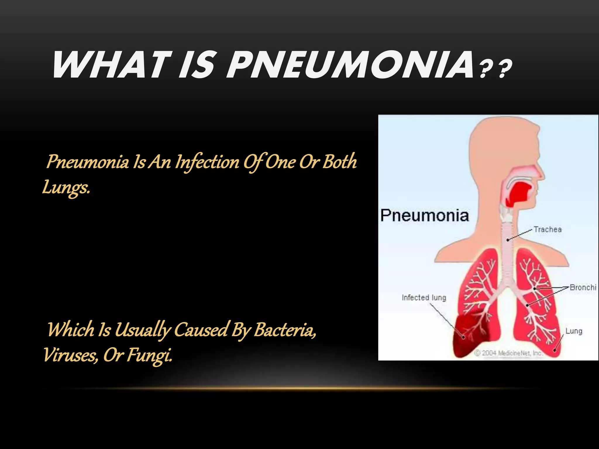 Fungal pneumonia | PPTX