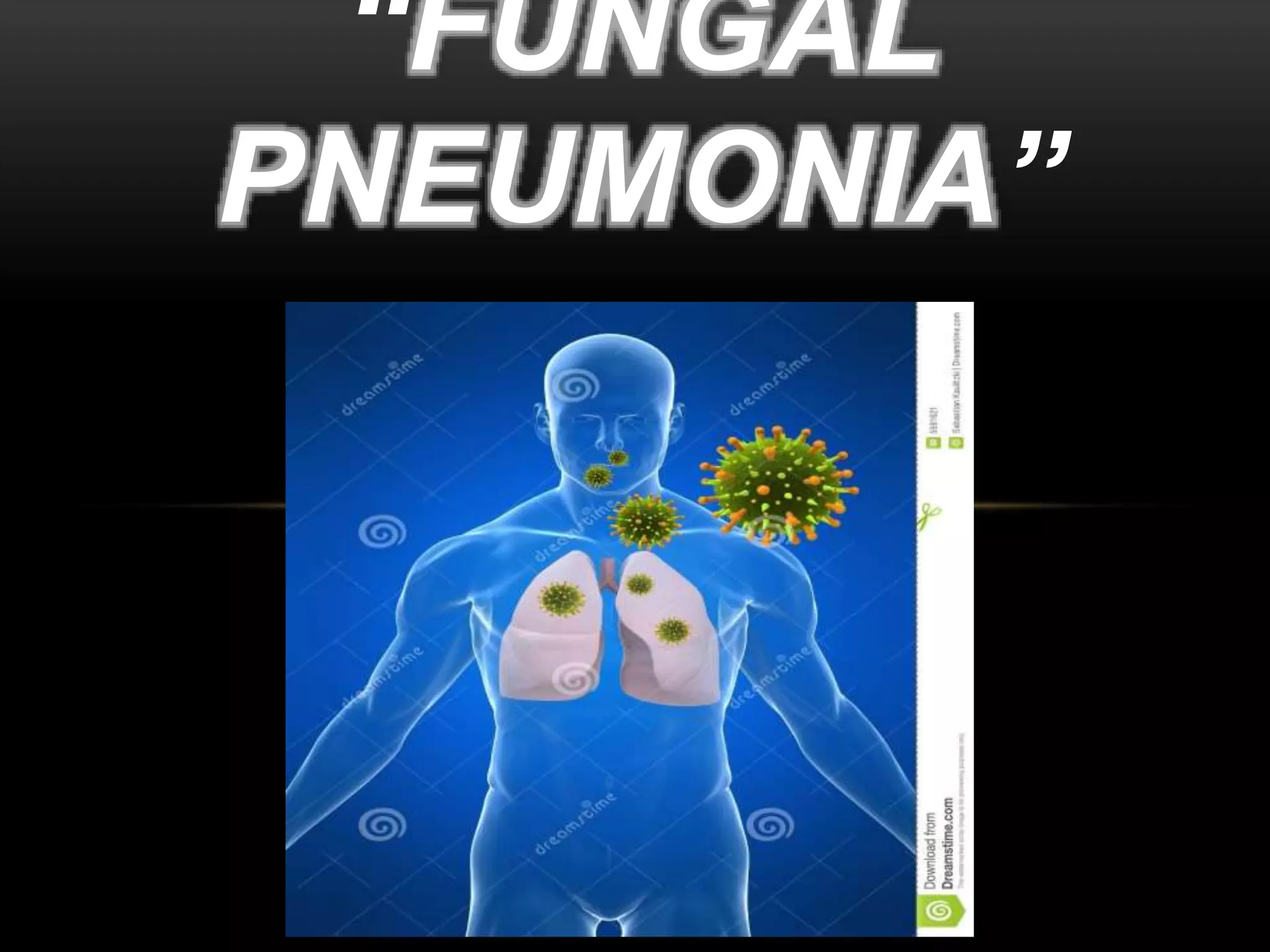 Fungal Pneumonia Cartoon Fungal Vaccine Development: State Of The Art