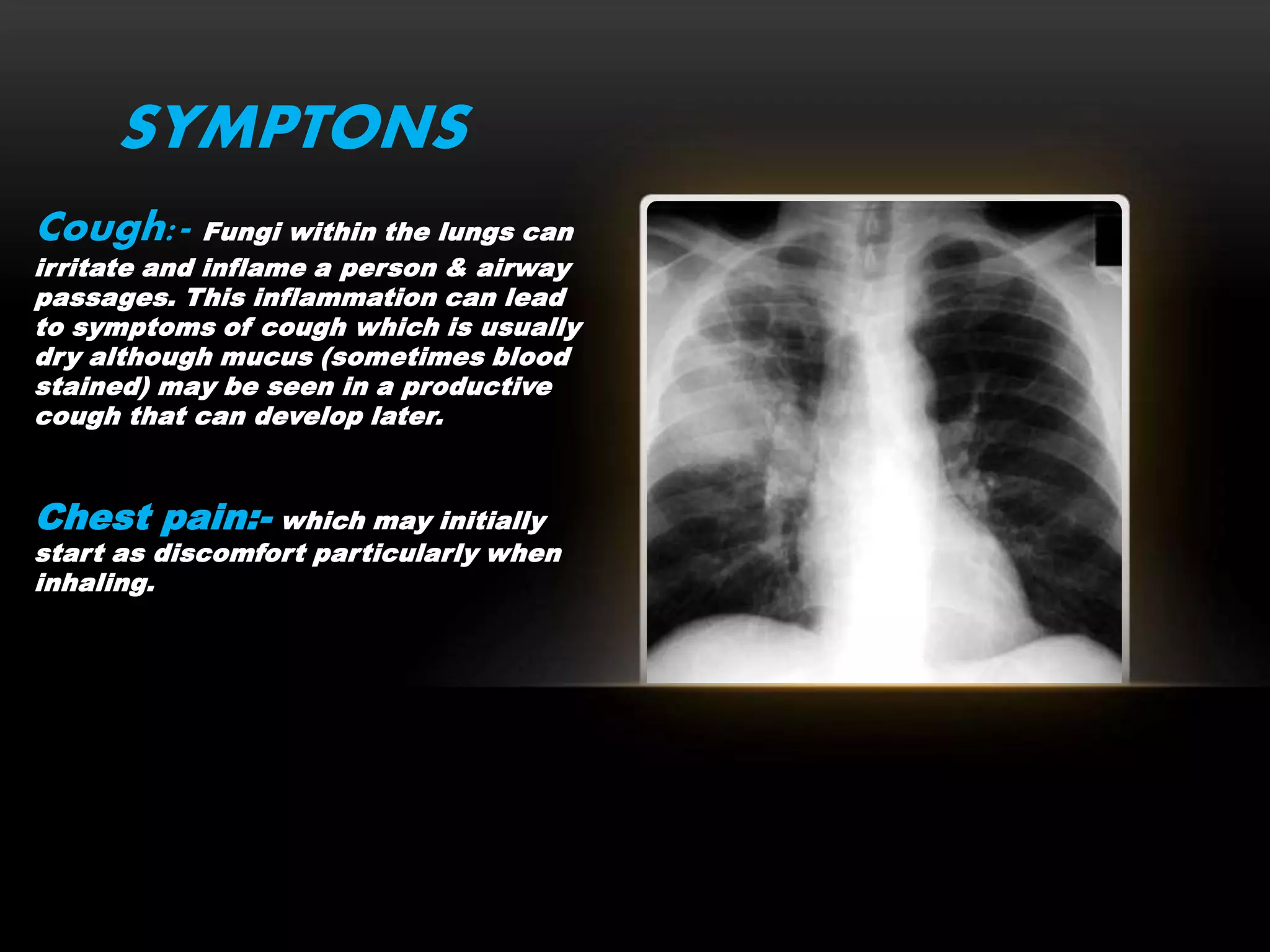 Fungal pneumonia | PPTX