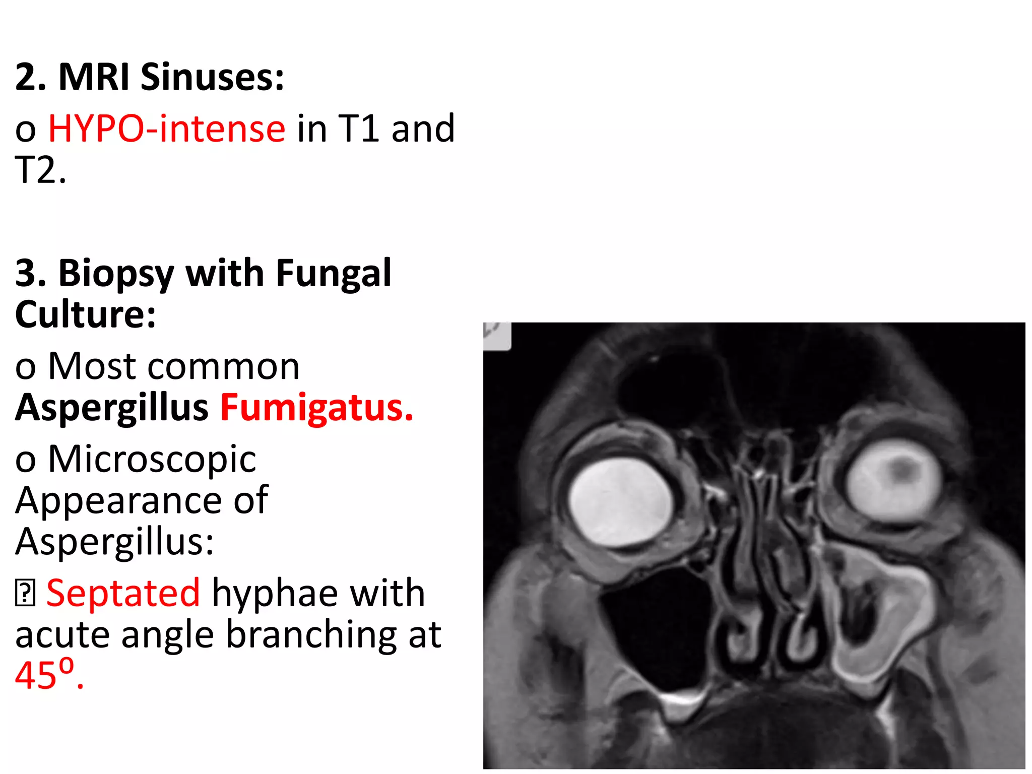 Fungal Rhino-sinusitis.pptx