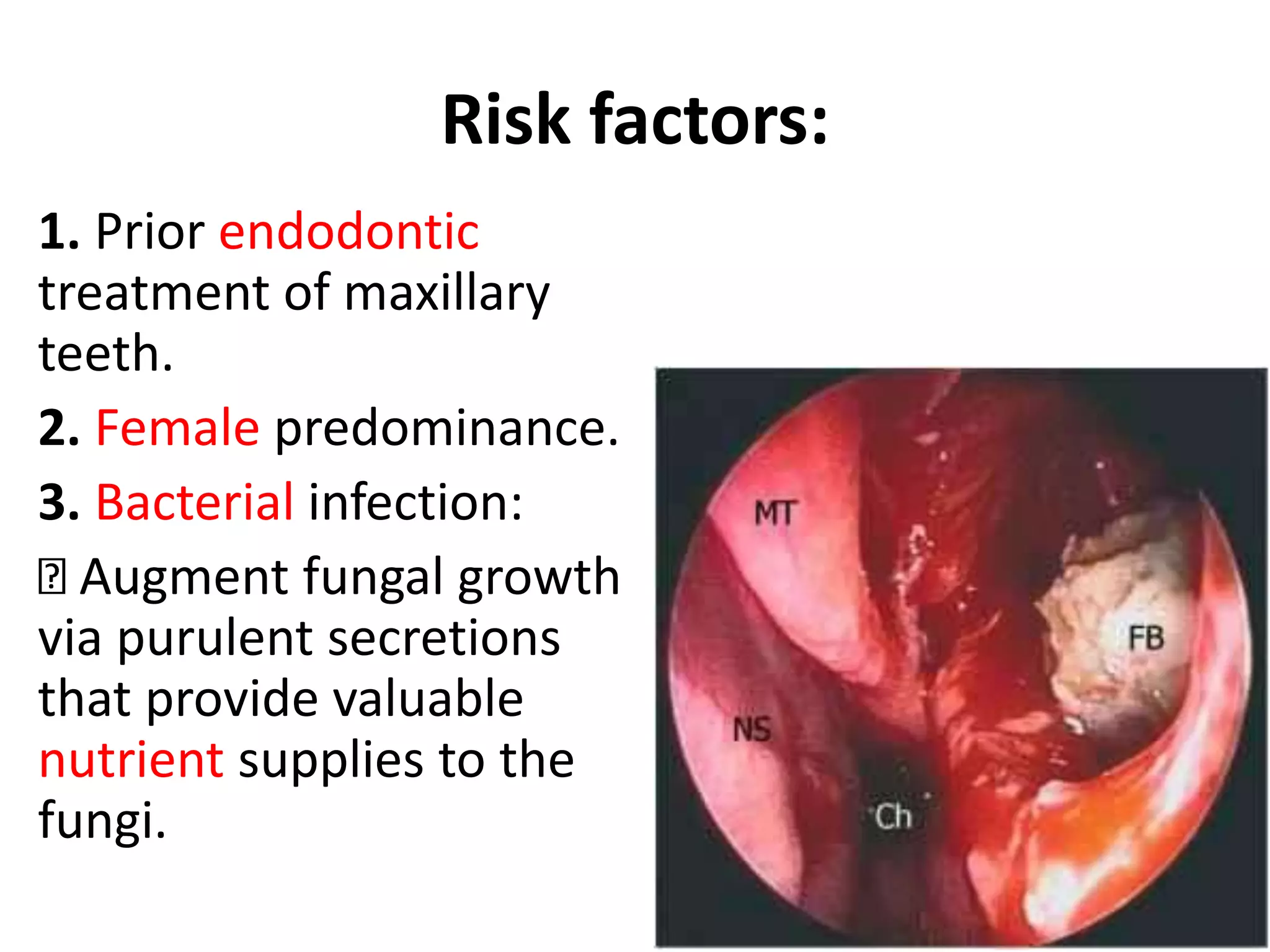 Fungal Rhino-sinusitis.pptx
