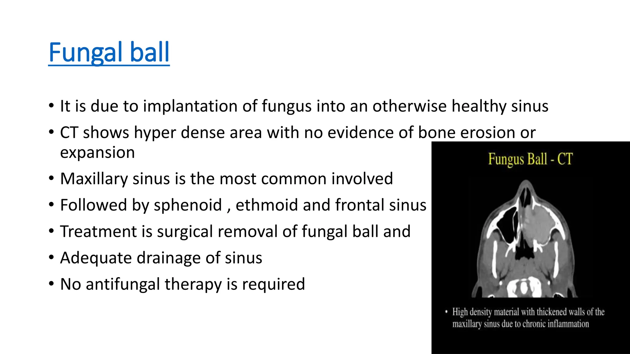 FUNGAL RHINOSINUSITIS CLINICAL FEATURES AND TREATMENT | PPTX