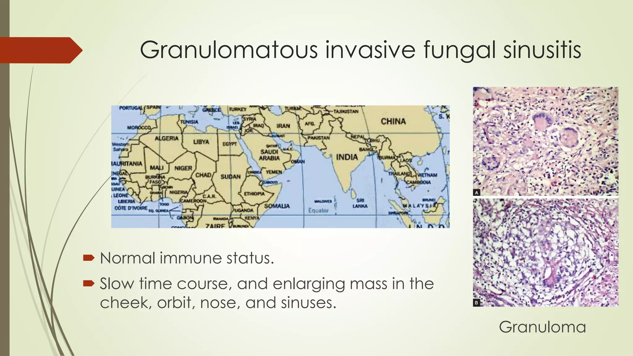 Fungal sinusitis | PPTX