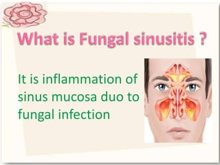 Fungal sinusitis | PPTX