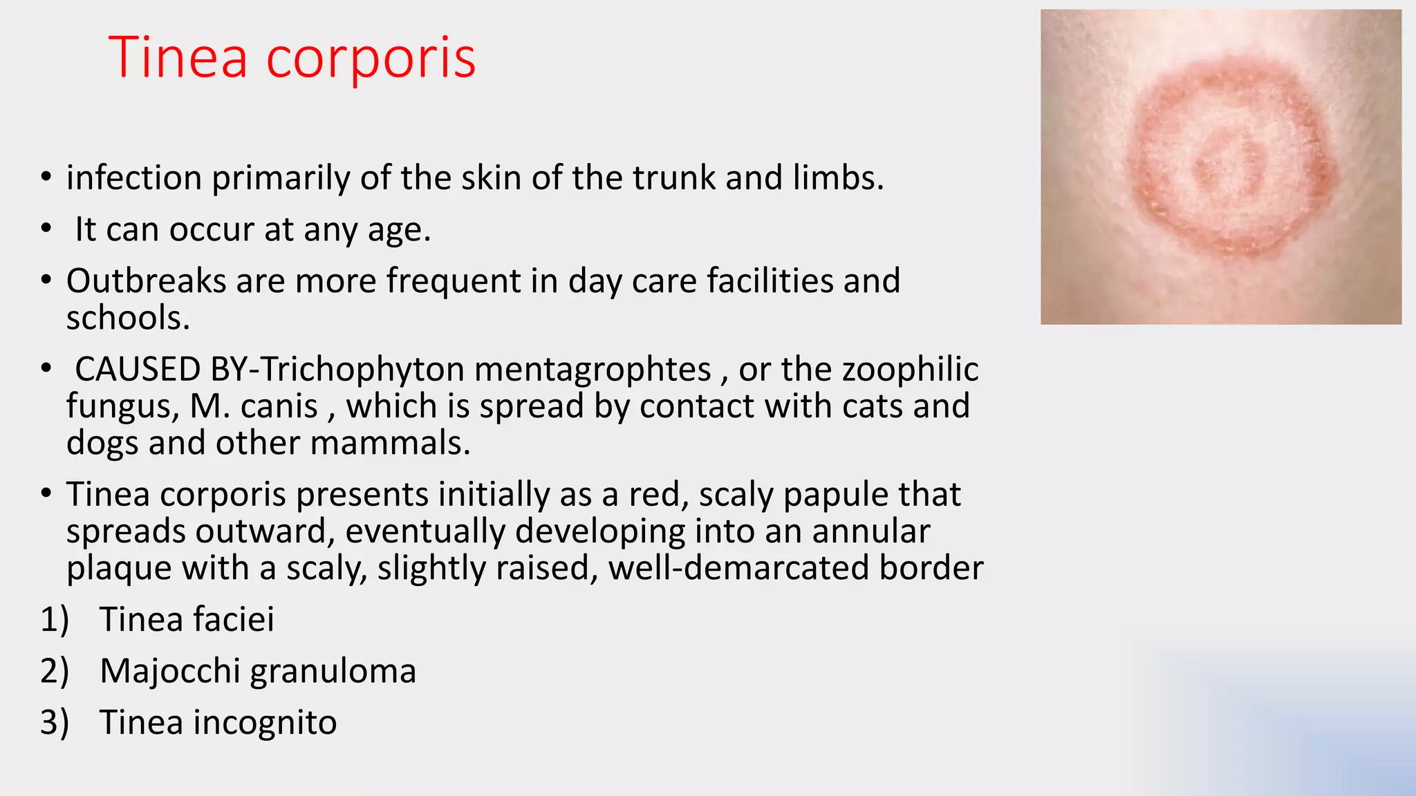Fungal skin infection.pptx