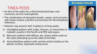 Fungal skin infection.pptx