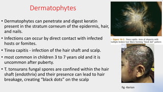 Fungal skin infection.pptx