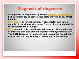 Fungal skin infection (ringworm) | PPTX