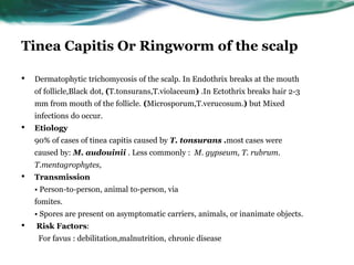 Fungal skin infection | PPTX