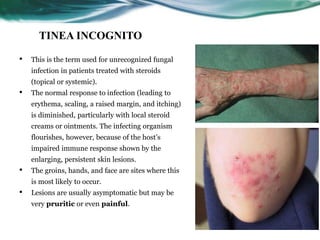 Tropical Skin Fungus