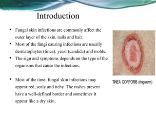 Fungal skin infection | PPT