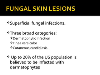 Detailed notes on Fungal Skin Infections.ppt